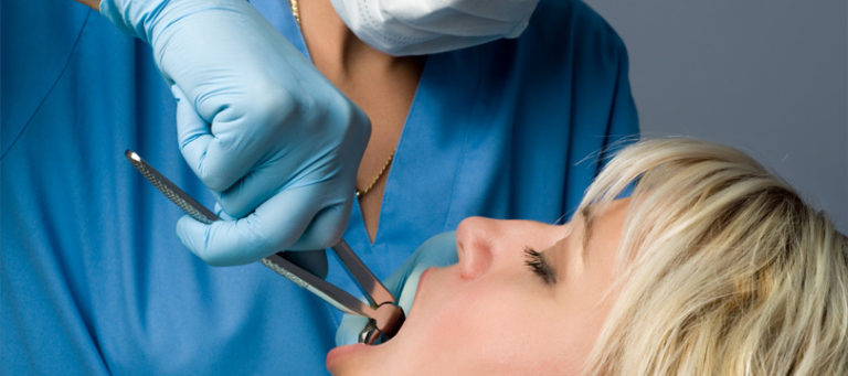woman-getting-tooth-extraction | Studio City Dental Center